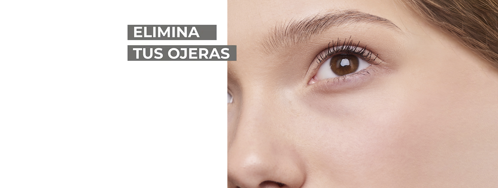 Tratamiento de Tratamiento de Ojeras en Madrid - Instituto Médico Ricart